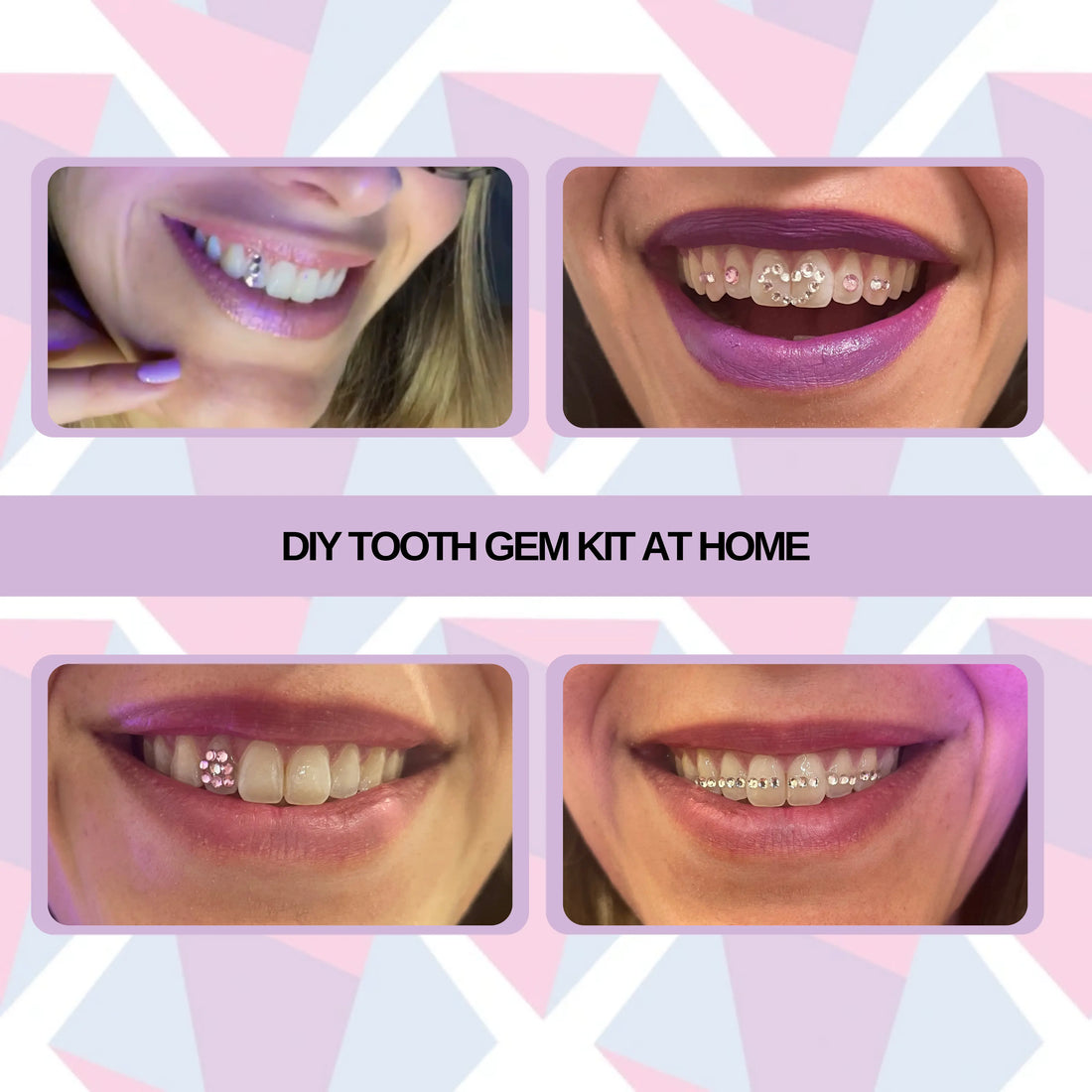 Professional Tooth Gem Kit - DIY Dental Gems with Free Shipping