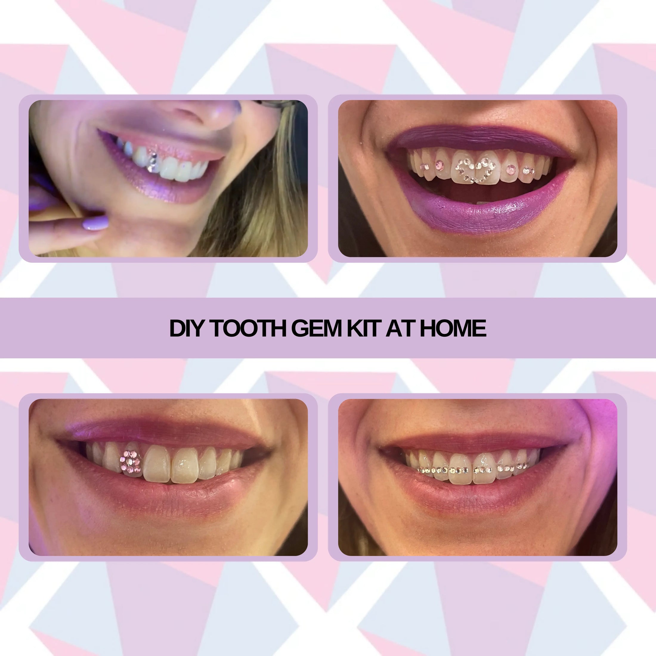 Professional Tooth Gem Kit - DIY Dental Gems with Free Shipping